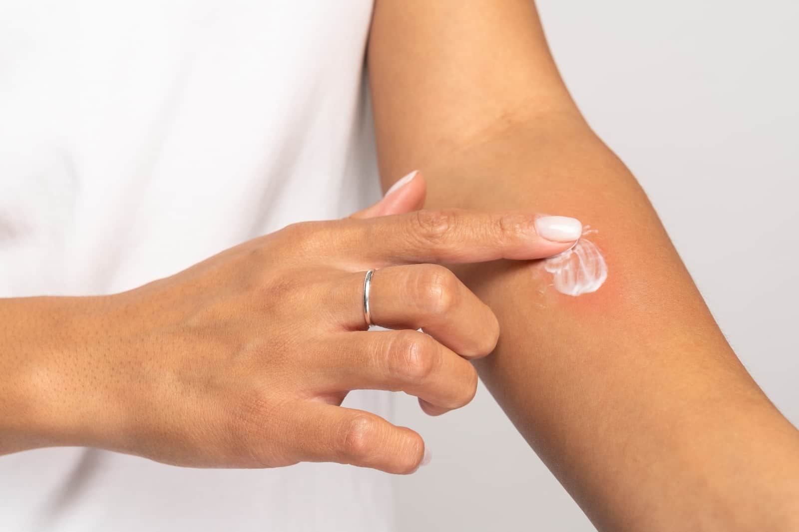 Fucidin Tattoos