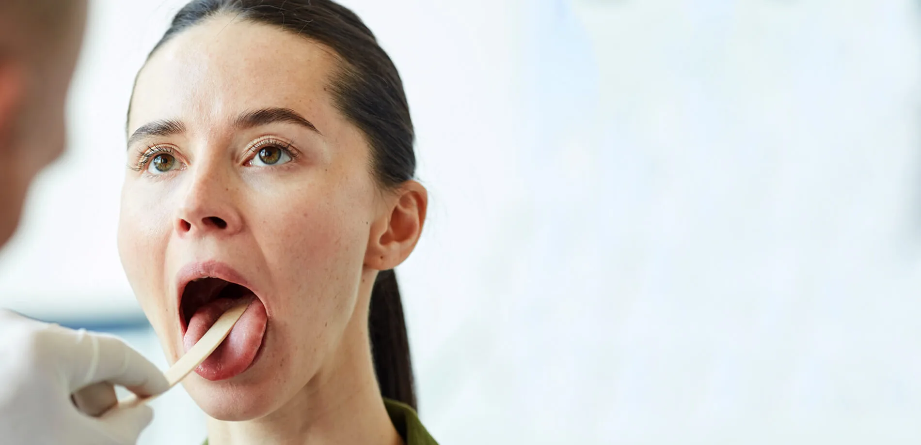 Buy Medications for Thrush treatment at Pharmacy Planet