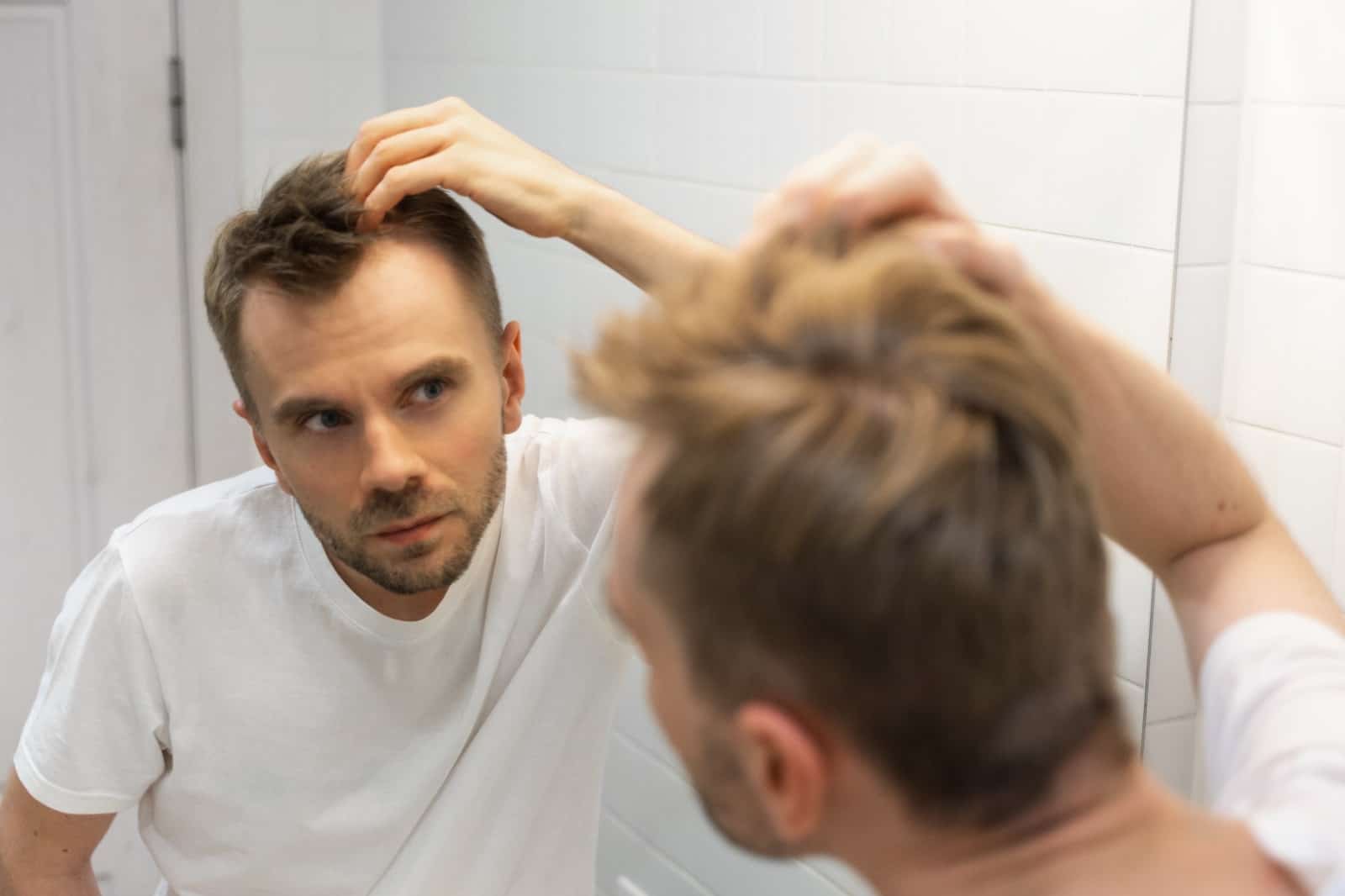 Exploring the Pros and Cons of Using Finasteride for Hair Loss
