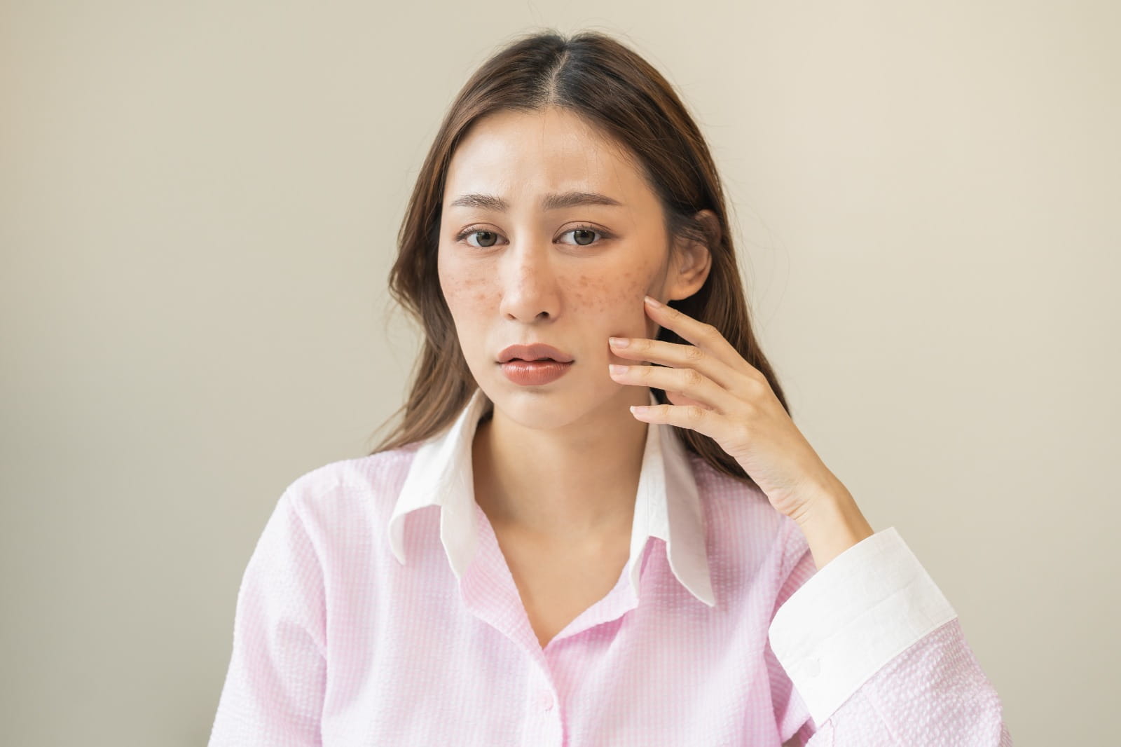 Hormonal Imbalance And Acne: What You Need To Know?