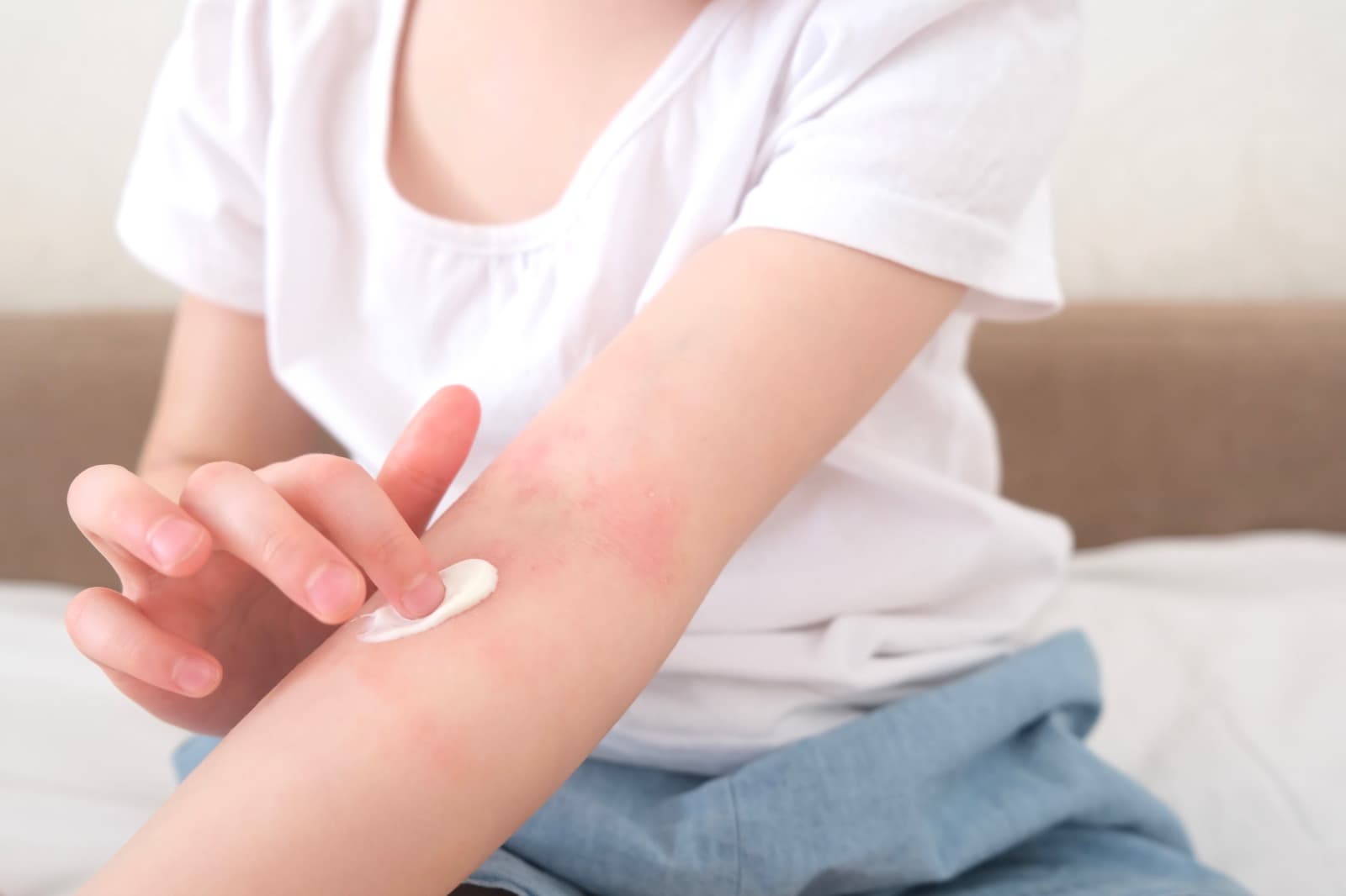 Plaster Allergy Causes and Symptoms: What to Do If You’re Allergic to ...